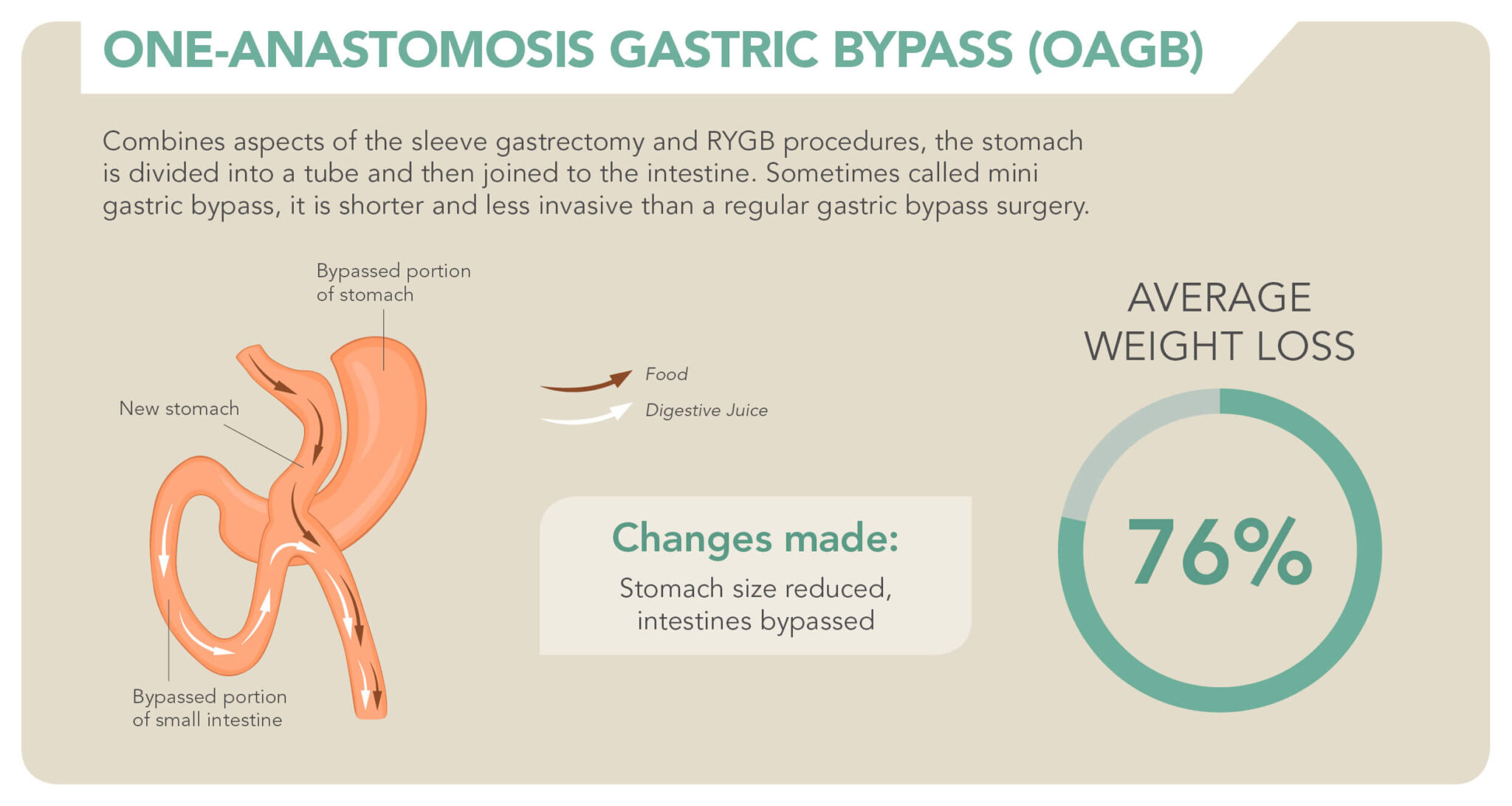 Bariatric Surgery - Island Hospital