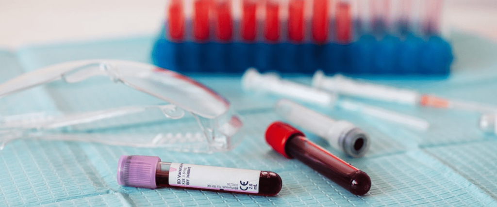 A Complete Guide to Blood Tests & When You Need Them