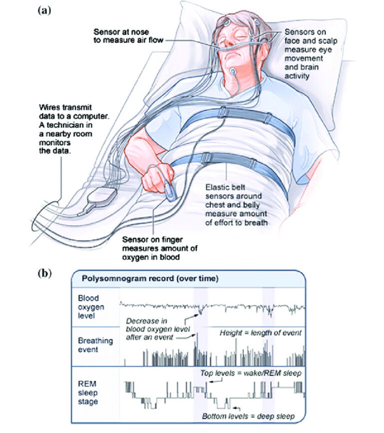 Malaysian Sleep Study: What You Need to Know