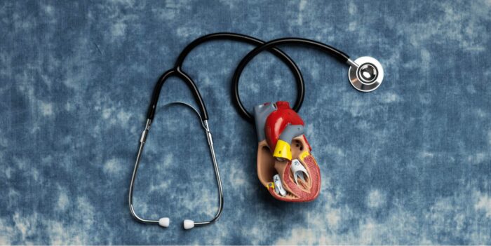 Coronary Artery Disease (CAD): A Guide for Understanding Your Heart Health