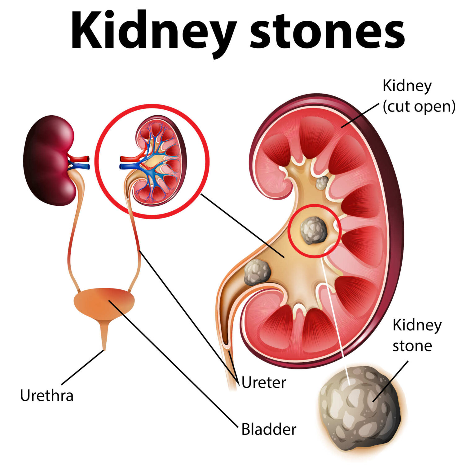 Recognising the Symptoms of 5 Common Urologic Diseases - Island Hospital
