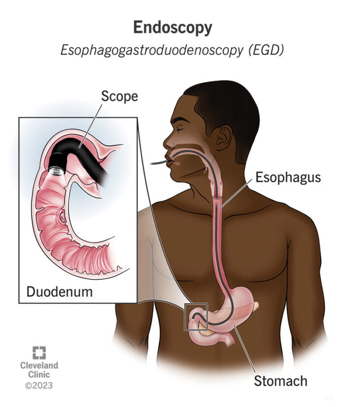 A Compassionate Guide to Gastroscopy vs. Endoscopy - Island Hospital